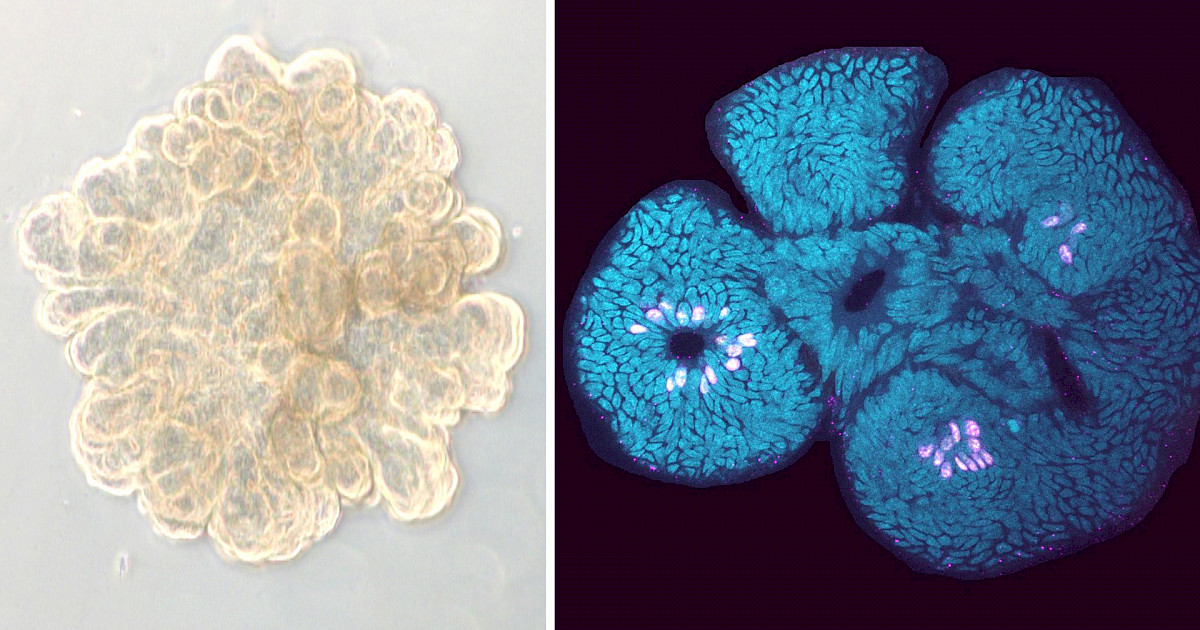 Lupaavan keliakialääkkeen toimivuus gluteenin aiheuttaman ...